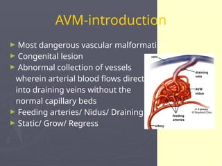 Arteriovenous Malformation Arteriovenous Malformation | PPTX