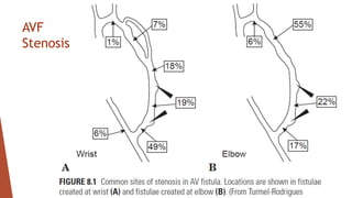 Arteriovenous vascular access complications | PPTX