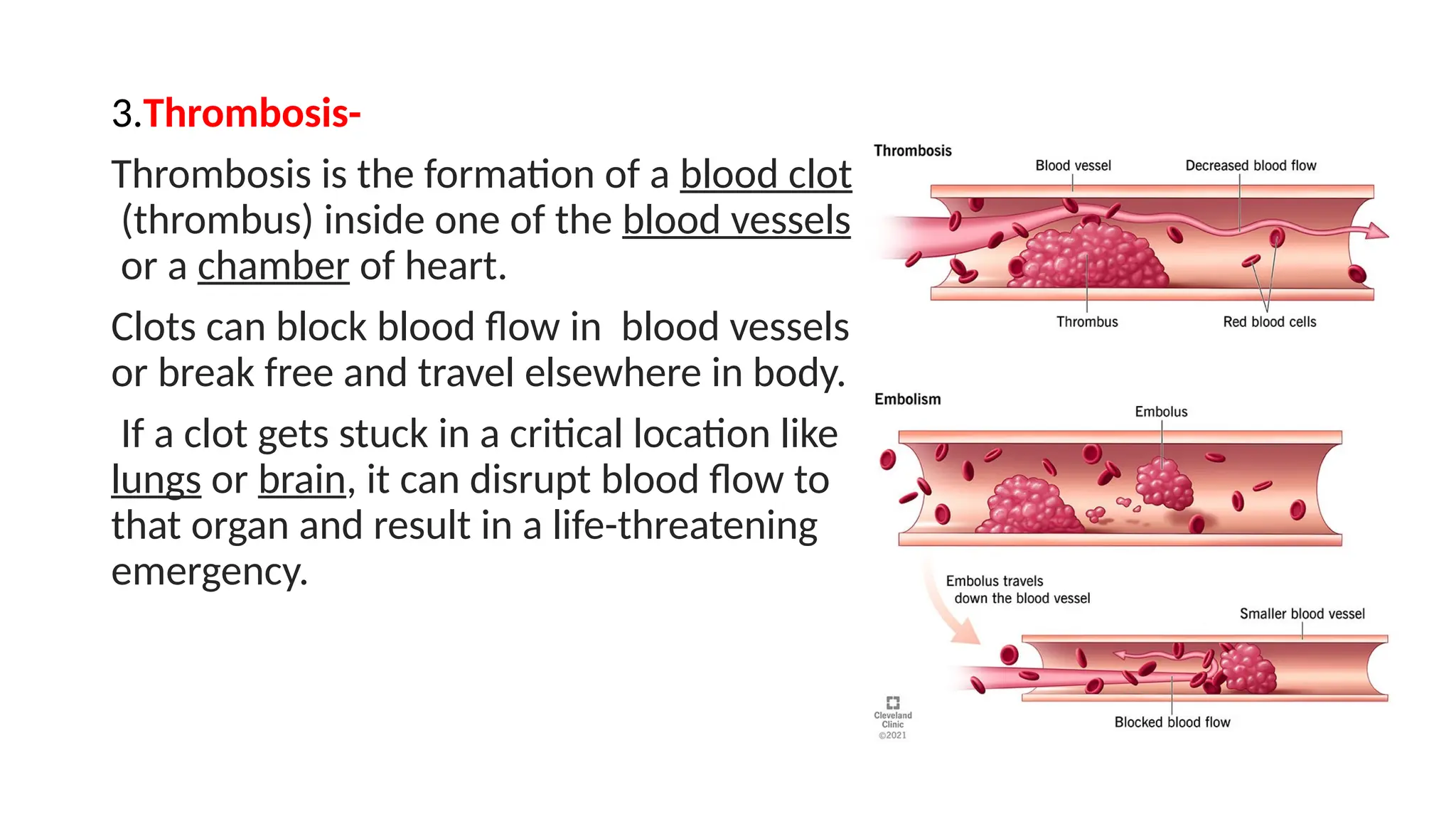 Description of Artery and Vein with its Applied Anatomy | PPTX