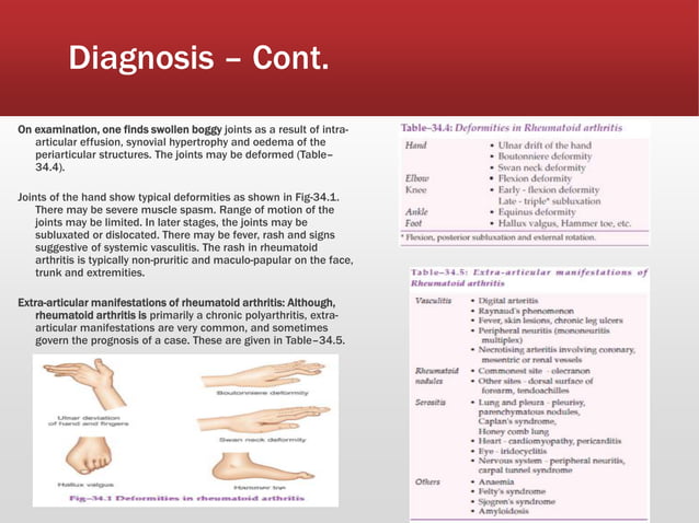 Arthiritis and related Diseases-1.pptx