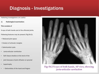Arthiritis and related Diseases-1.pptx