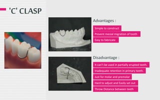 clasps in removable orthodontic appliance | PPTX