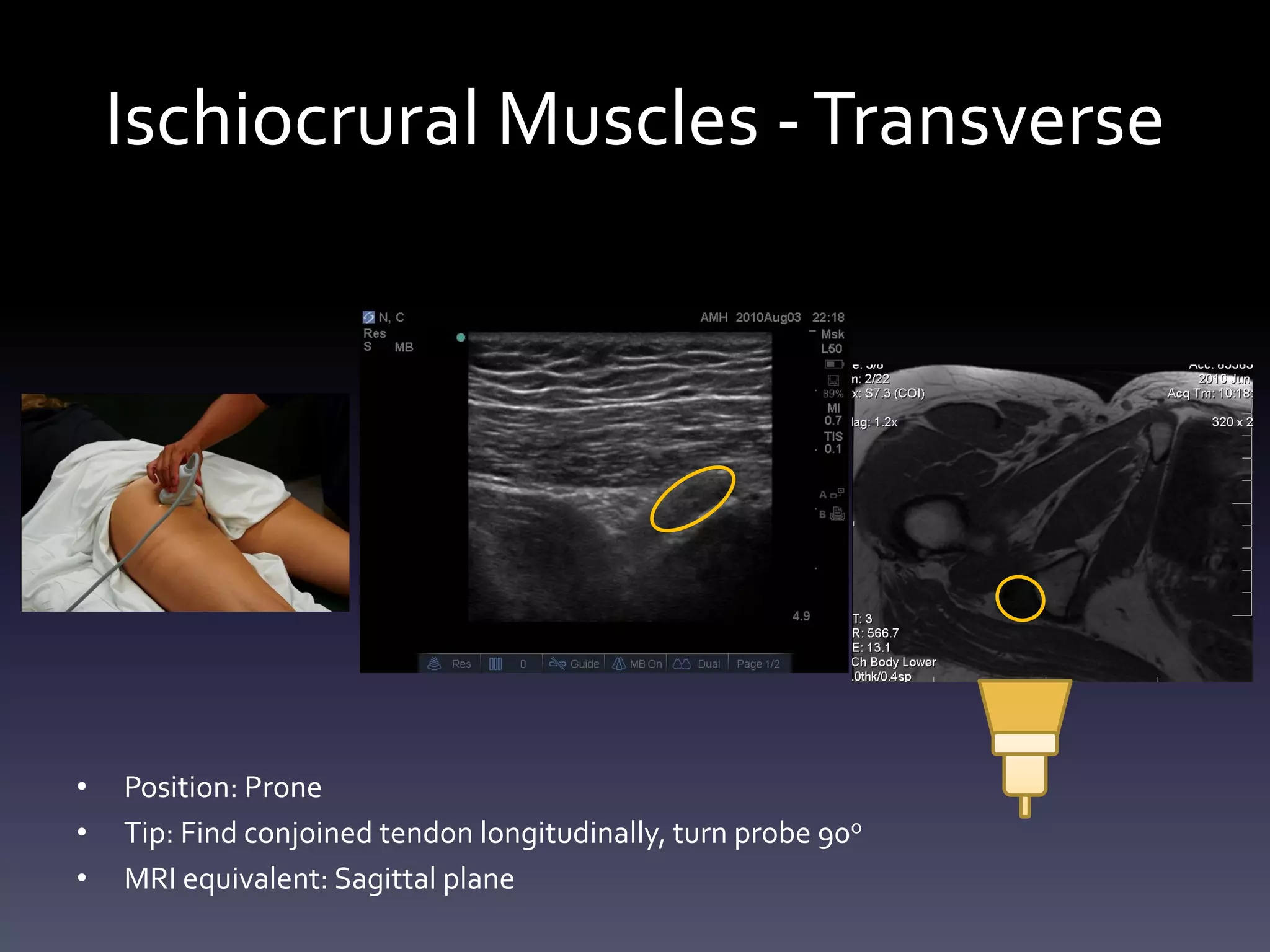 Ultrasound - Hip | PDF