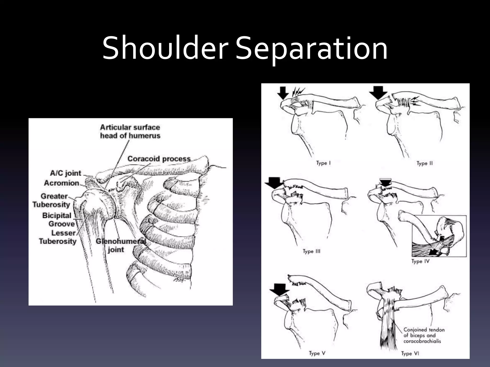 AC Separations | PDF
