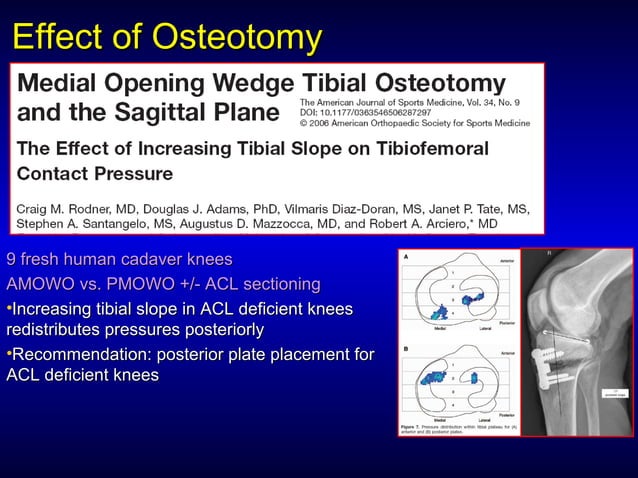 Medial Opening Wedge High Tibial Osteotomy | PPT | Bone and Joint ...