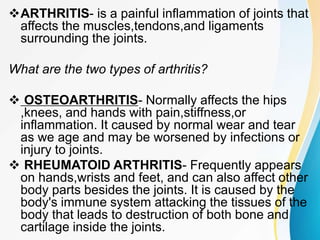 Arthritis | PPT