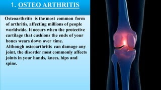 presentation on arthritis | PPTX