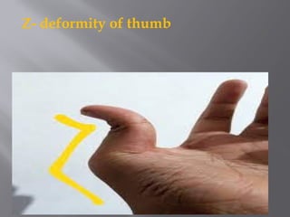 ARTHRITIS and Types,causes,pathophysiology,clinicalanifestations ...