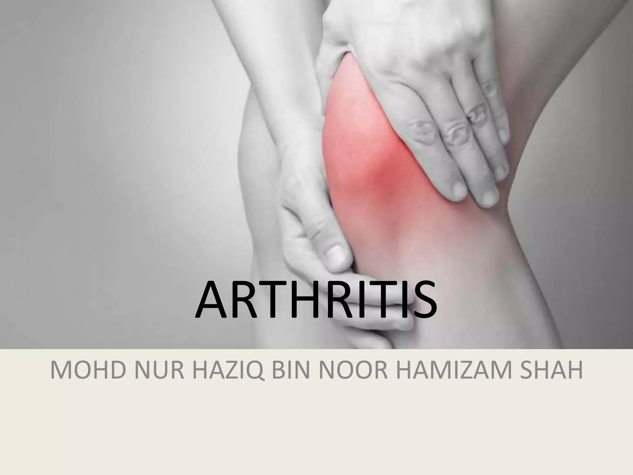 Arthritis cme haziq | PPTX