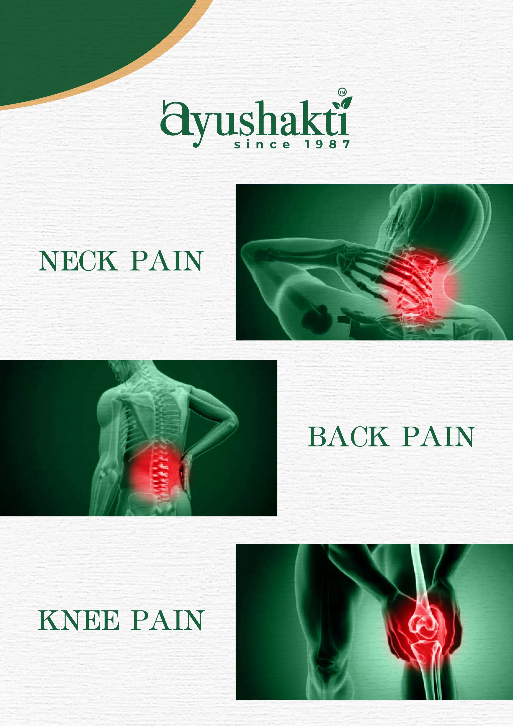 Arthritis e book | PDF