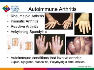 Living with Arthritis - Lauren Kennish - 10.15.19