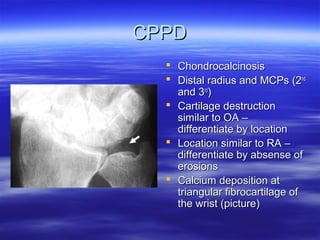 Arthritis of the hands | PPT