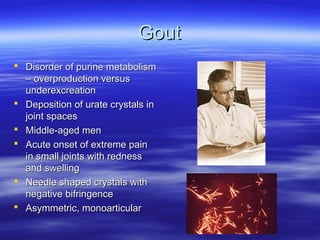 Arthritis of the hands | PPT