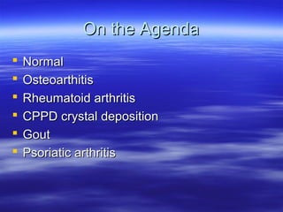 Arthritis of the hands | PPT