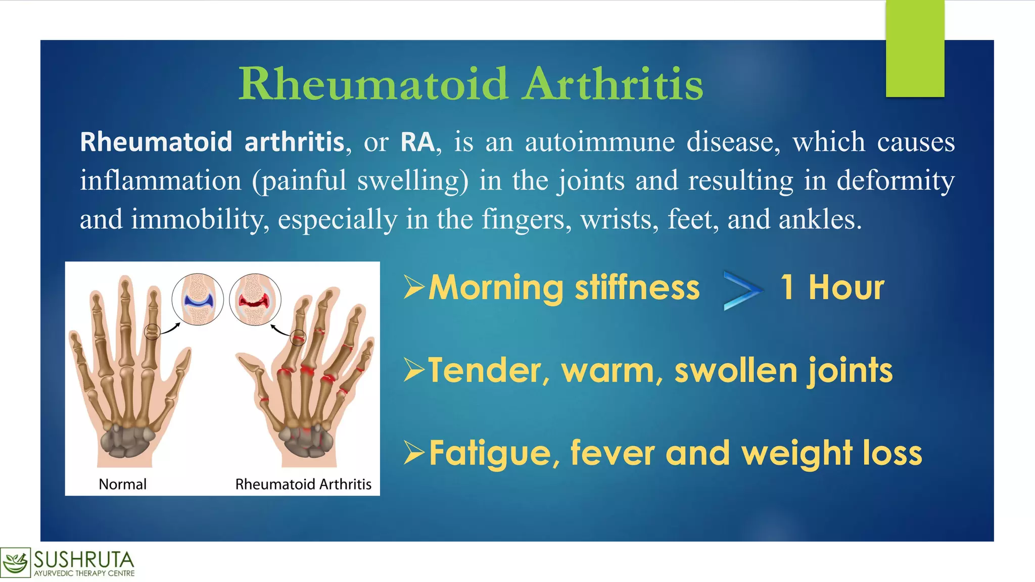 Ayurvedic view on Rheumatoid Arthritis | PDF