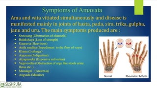 Ayurvedic view on Rheumatoid Arthritis | PDF