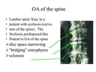 Educational Grand Rounds: Arthritis | PPT