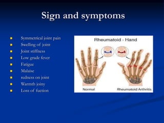 Arthritis ppt priya | PPT