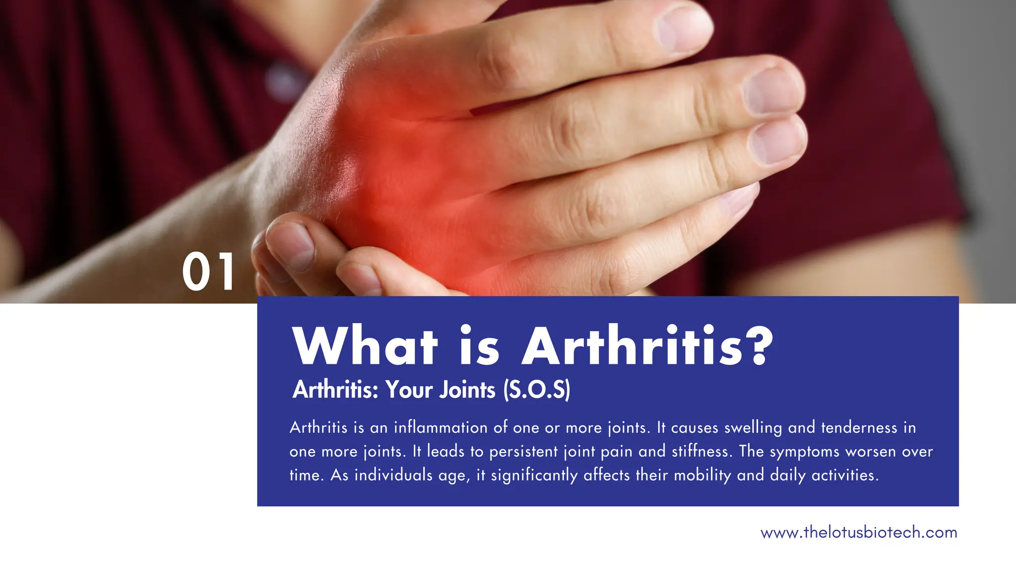 Arthritis Treatments, Symptoms & Causes - The Lotus Biotech | PPT