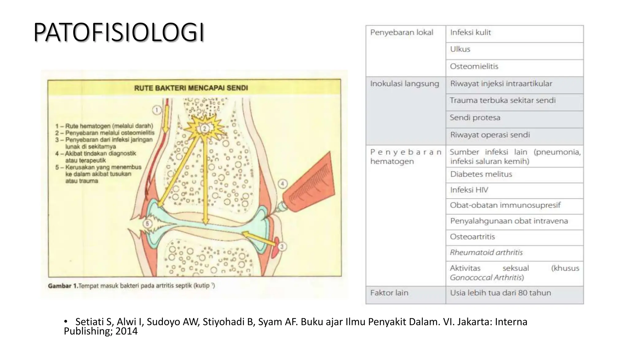 Arthritis Septik - sxxxxxxxxxxxxxxxxxxxxx | PPT