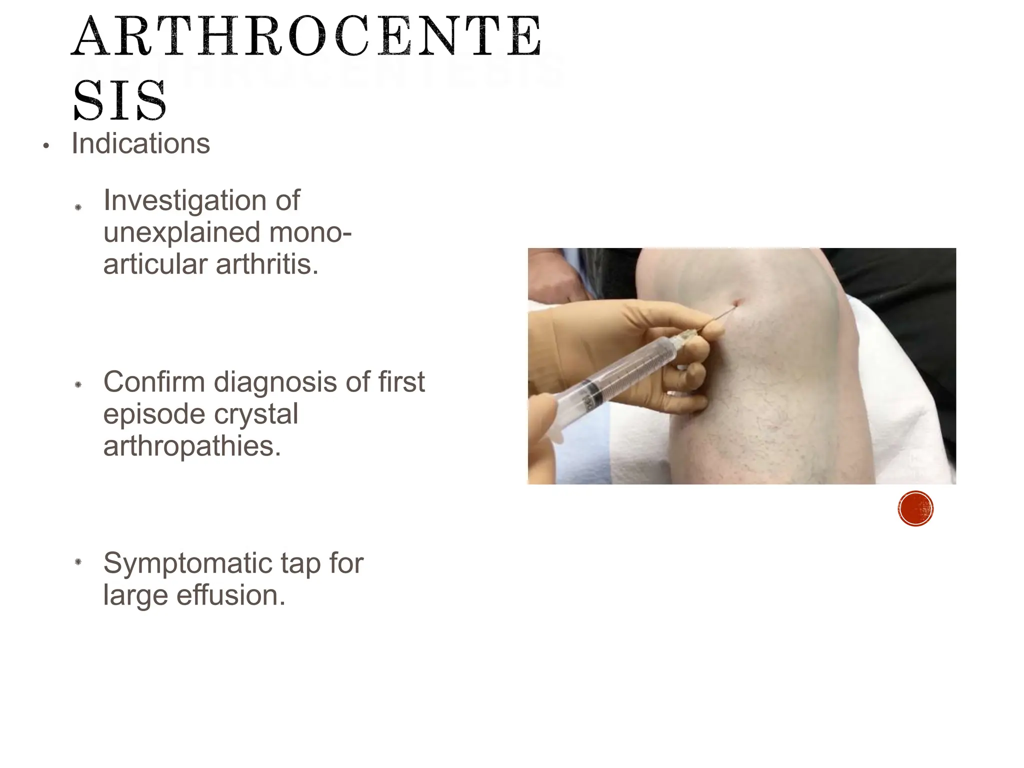 Arthrocentesis. in Orthopaedics .pptx