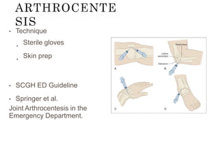 Arthrocentesis. in Orthopaedics .pptx