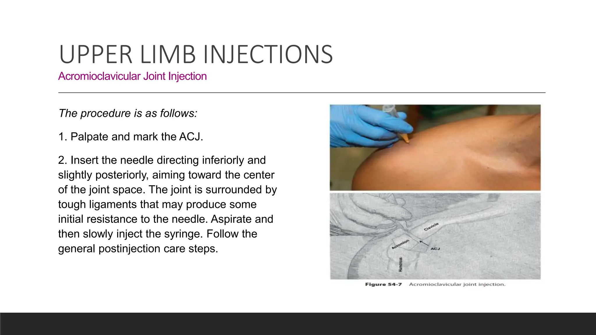 Arthrocentesis and Injection of Joints.pptx