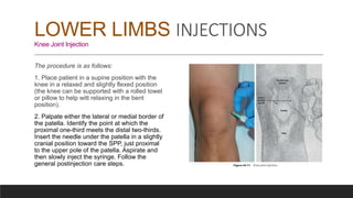 Arthrocentesis and Injection of Joints.pptx