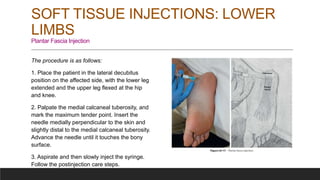 Arthrocentesis and Injection of Joints.pptx