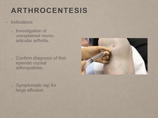 arthrocentesisppt arthicentesis approach | PDF