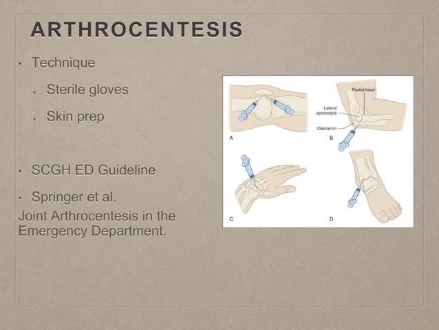 Arthrocentesis | PPTX | Bone and Joint Conditions | Diseases and Conditions