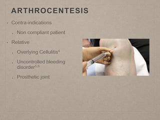 Arthrocentesis | PPTX