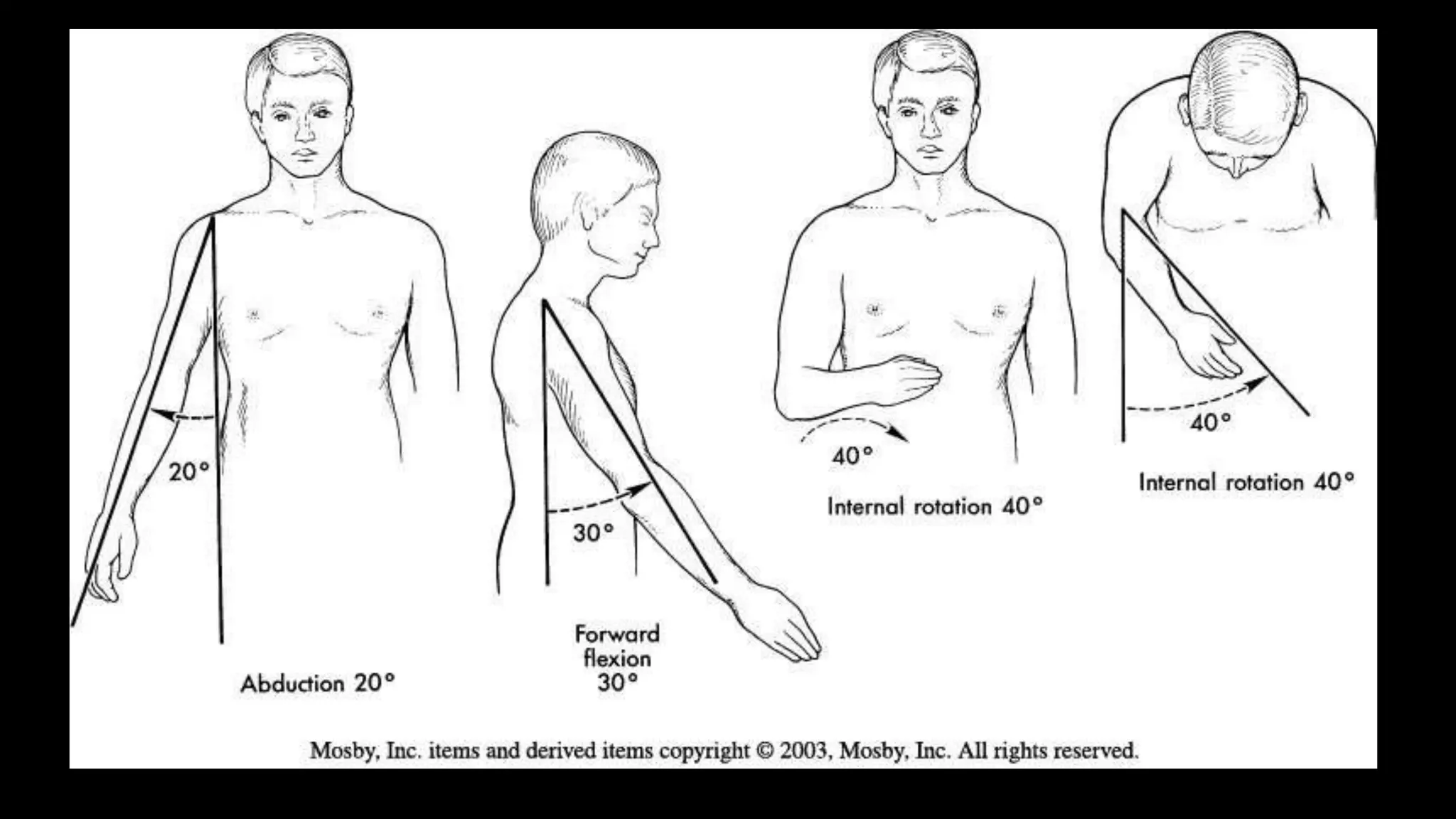 Arthrodesis indications & contraindications -PAWAN | PPTX