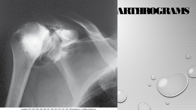 Arthrograms(3)