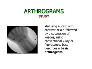 Arthrograms Presentation | PPT