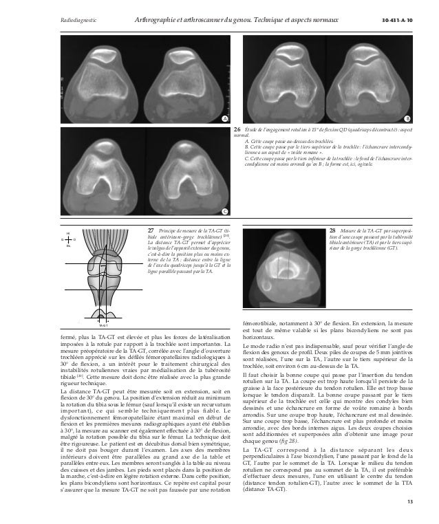 Arthrographie et arthroscanner du genou