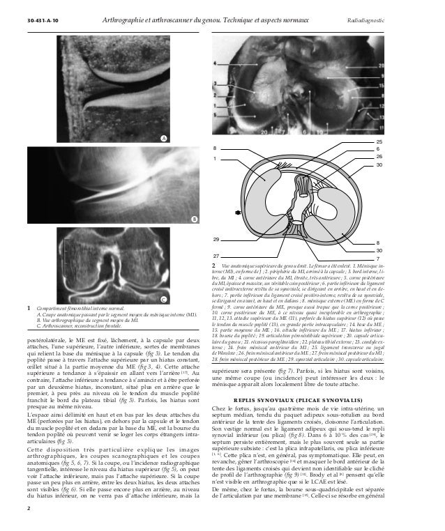 Arthrographie et arthroscanner du genou