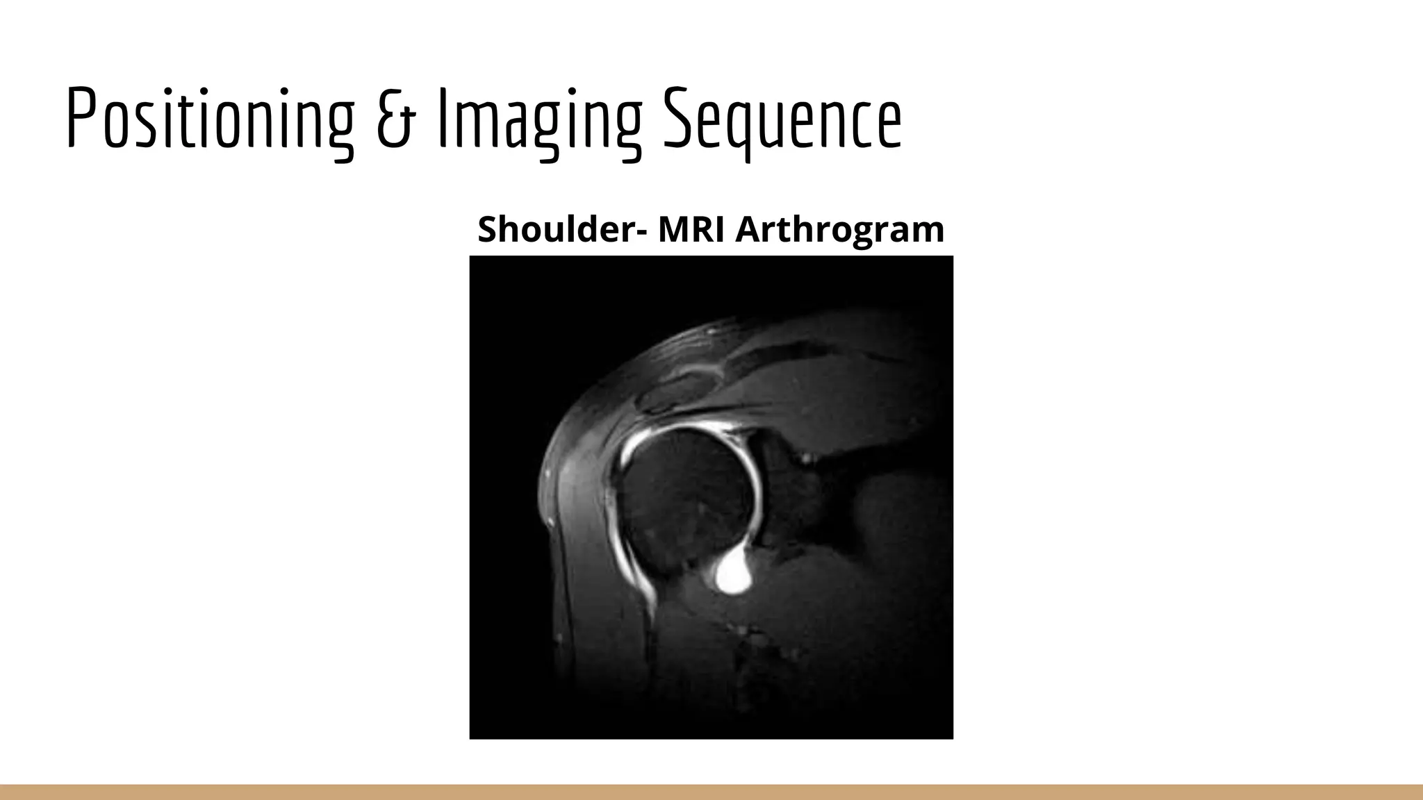 Arthrography of the Shoulder, Ankle and Wrist.pptx