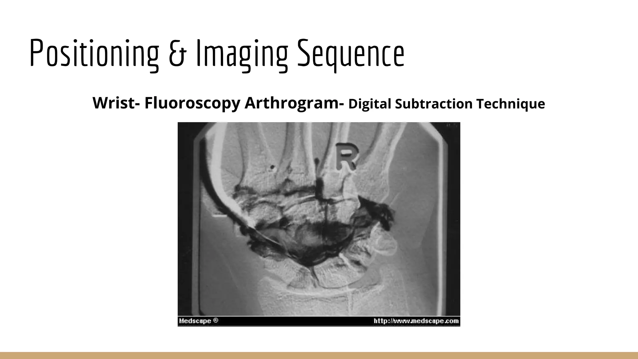 Arthrography of the Shoulder, Ankle and Wrist.pptx