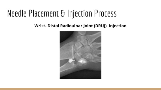 Arthrography of the Shoulder, Ankle and Wrist.pptx