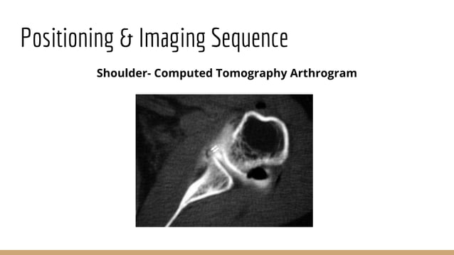 Arthrography of the Shoulder, Ankle and Wrist.pptx