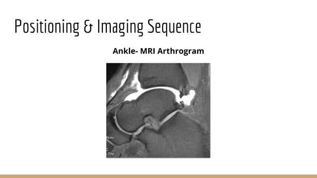 Arthrography of the Shoulder, Ankle and Wrist.pptx