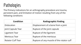 Arthrography of the Shoulder, Ankle and Wrist.pptx