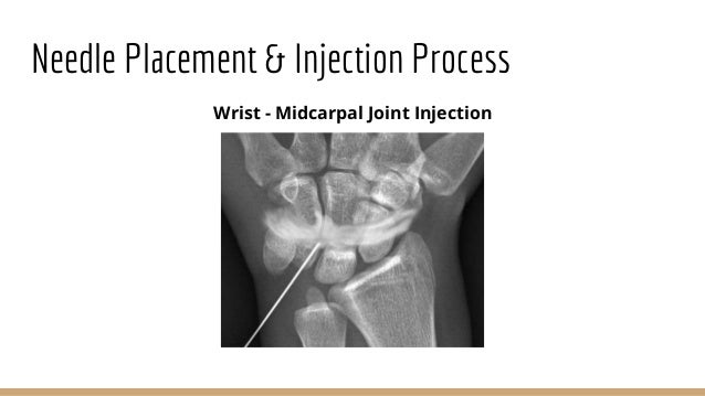 Arthrography of the Shoulder, Ankle and Wrist.pptx