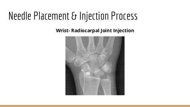 Arthrography of the Shoulder, Ankle and Wrist.pptx