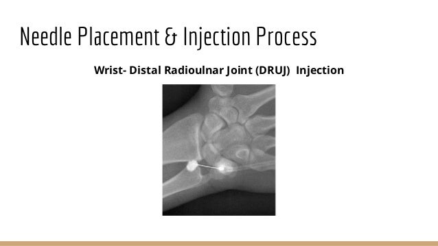 Arthrography of the Shoulder, Ankle and Wrist.pptx