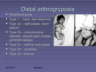 Arthrogryposis | PPT