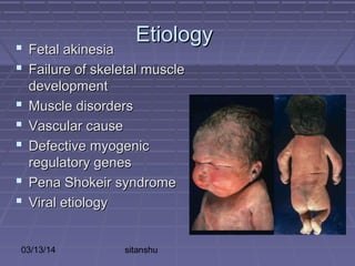 Arthrogryposis | PPT