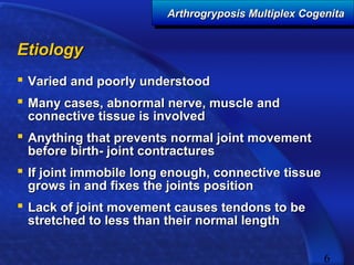 Arthrogryposis congenita | PPT