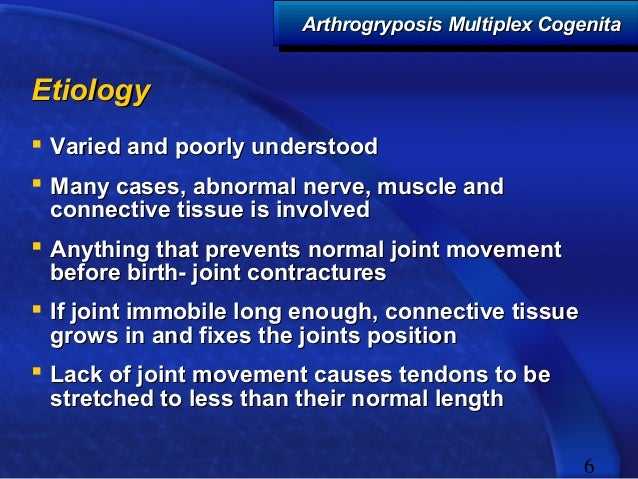 Arthrogryposis congenita